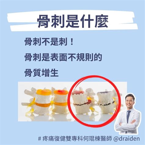 頸椎骨刺！骨刺是什麼？ 何琨棟醫師 Dr Aiden