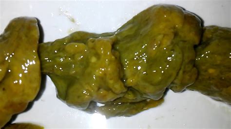 Mucoid Plaque — Sura Detox Retreats