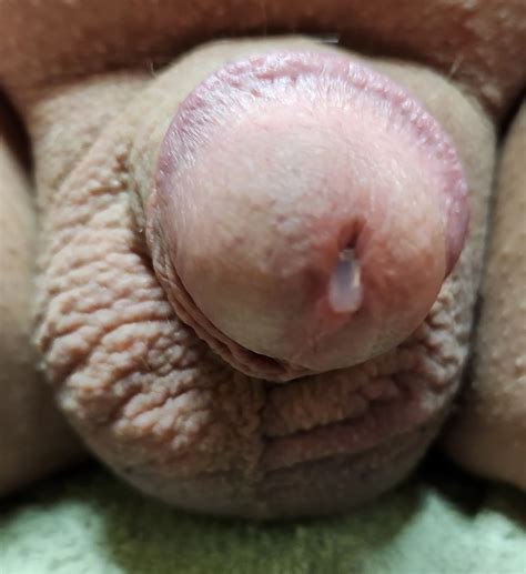 Small Cock Pre Cum 5 Nude Pics Xhamster