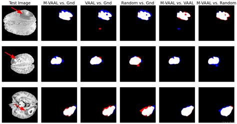 基于多模态变分对抗主动学习的下游医学图像分析任务 m vaal multimodal variational adversarial active csdn博客