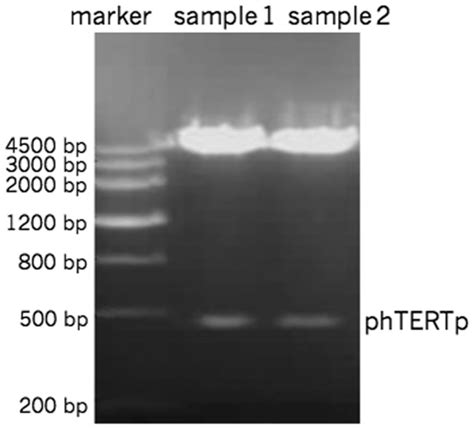 Phtertp Luc And Pgl4 17 Luc2 Neo Were Separately Digested With