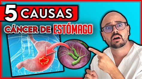 5 CAUSAS del CÁNCER DE ESTÓMAGO que DESCONOCIAS NECESITAS saber ESTO