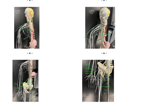 Nerve Plexuses And Peripheral Nerves P3 Diagram Quizlet