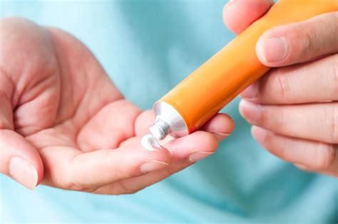 여자의 손 그녀는 스테로이드를 사용 하 여 외부 유형을 적용 연고에 대한 스톡 사진 및 기타 이미지 연고 보습제 크림색