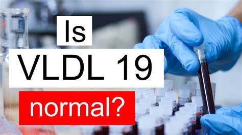 Is Vldl 19 Normal High Or Low What Does Very Low Density Lipoprotein