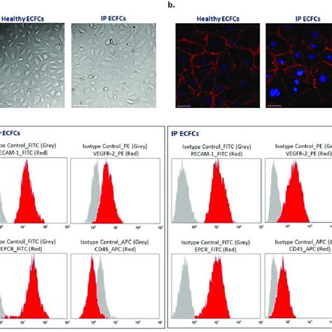 Phenotype Characterization Of Endothelial Colony Forming Cells Ecfcs