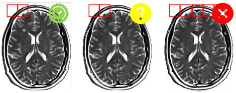 H Quantitative Estimation Of Visual Sen Noambelab