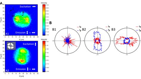 Polarization Sensitive Two Photon Microscopy For A Label Free Amyloid