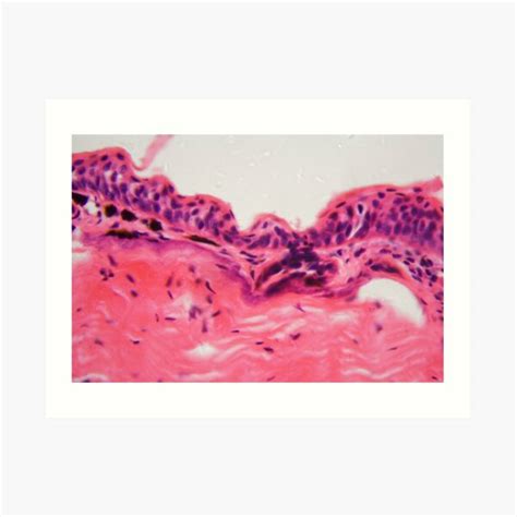 Amphibian Skin With Ulcer Under A Microscope Art Print By Zosimus Redbubble