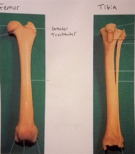 Femurtibia Diagram Quizlet