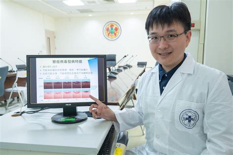 猴痘疫情升溫 斗六成大提醒兒童及免疫功能低下者嚴重威脅