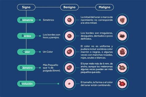 ¿cuáles Son Los Signos Y Síntomas Del Melanoma