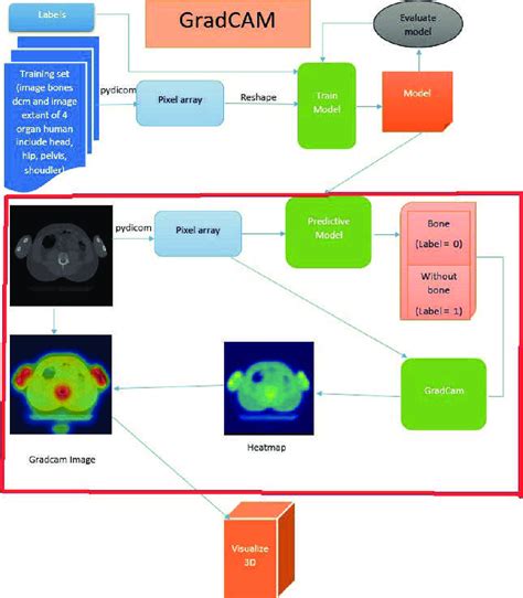 The Grad Cam Flowchart For Highlighting Bone Download Scientific Diagram