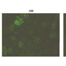 Effect Of Rhodiolae Kirliowii Radix Et Rhizoma Treatment On Virus