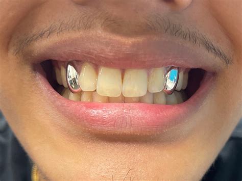 2x Sterling Silver 925 Grillz Any Teeth Free Worldwide Shipping Etsy