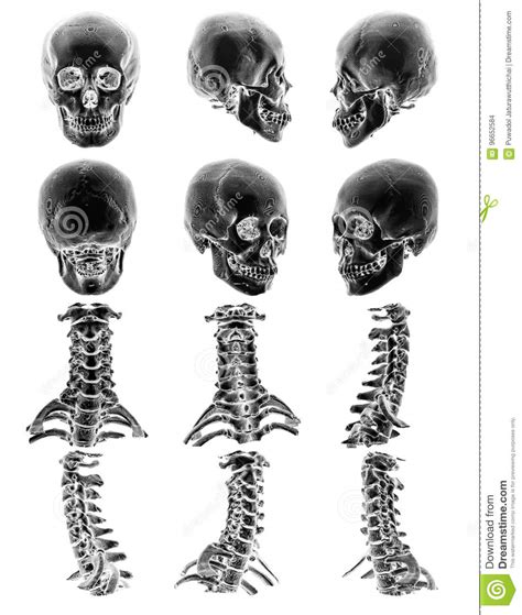 Ct Scan And X28 Computed Tomography And X29 With 3d Graphic Show Normal