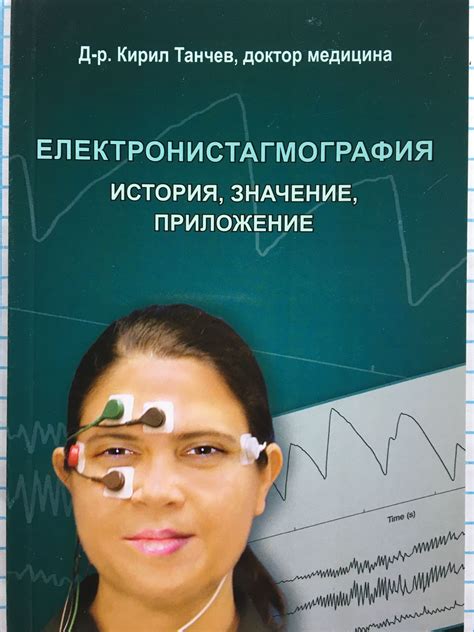 Електронистагмография История значение приложение Ортограф антикварна книжарница