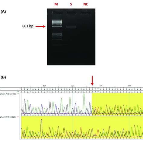 Calr Mutation Identified In The Analysed Athlete A Agarose Gel