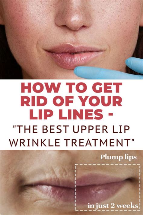 Get Plumper Smoother Looking Lips In Minutes Lip Wrinkle Treatment