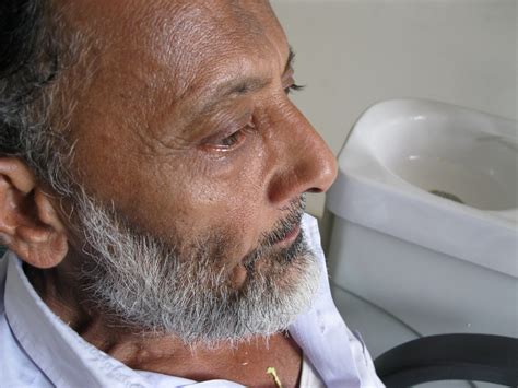 Dento Care Dental Clinics Sunflex Complete Denture