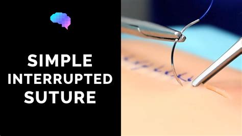 Simple Interrupted Suture Wound Suturing OSCE Guide UKMLA CPSA