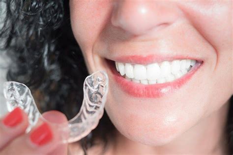 Innovating Comfort The Evolution Of Clear Aligner Materials By Odonto Odonto Clear Aligners
