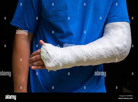 Brazo Y Codo Fotografías E Imágenes De Alta Resolución Alamy