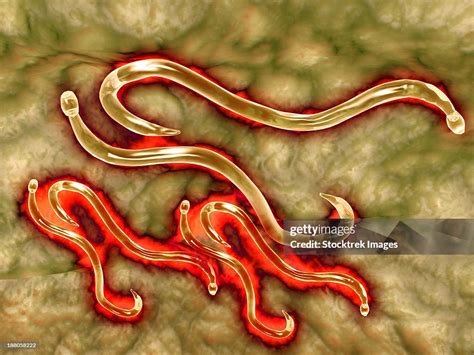 Microscopic View Of Hookworm The Hookworm Is A Parasitic Nematode That Lives In The Small