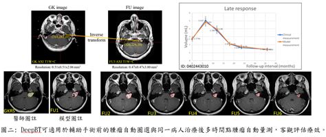Deepbt腦瘤智慧精準醫療系統：沿時間軸病灶偵測與放射手術療效預測 Future Tech Pavilion Futex未來科技館