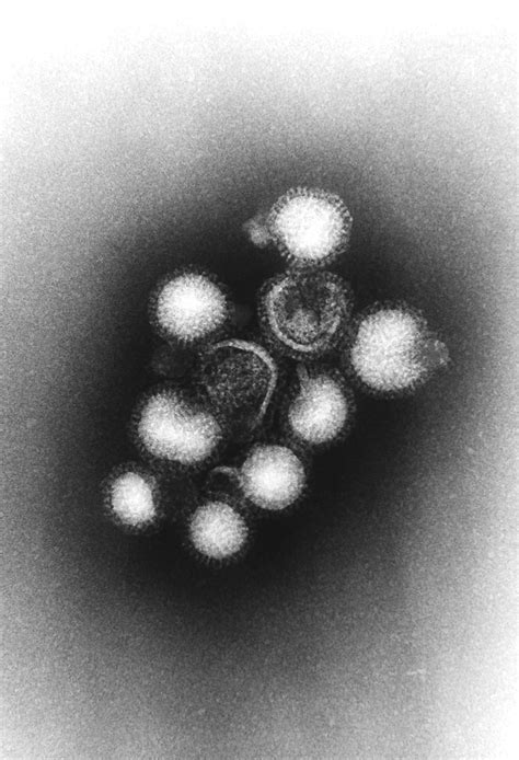 Free Picture Transmission Electron Micrograph Influenza Virus