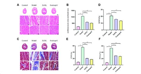XJEK Reduced MIR Induced Cardiomyocyte Hypertrophy And Collagen