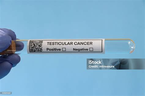 Gambar Closeup Tes Laboratorium Kanker Testis Berlabel Tabung Reaksi
