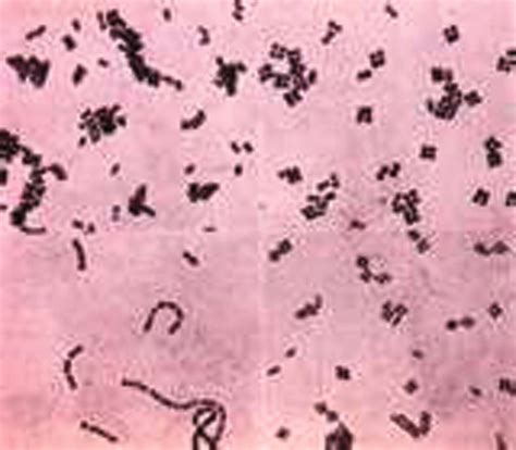 Microbiology Bacteriology Mycobacteriology Mycology Basicmedical Key