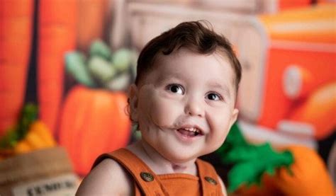 Juntos Pelo Braian Cirurgias Faciais Vaquinhas Online