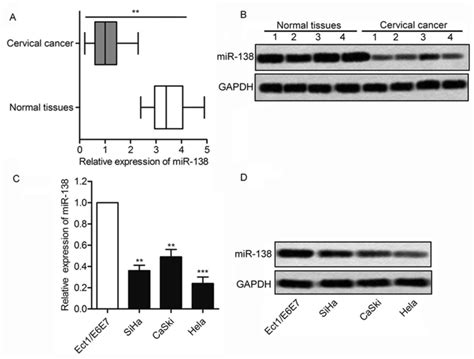 Long Non Coding RNA BCYRN1 Promotes The Proliferation And Metastasis Of