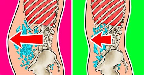 Proven Ways To Reduce Or Stop Bloating Quick Tips And Long Term Relief