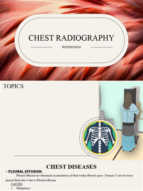 Chest Radiograph X Ray Views Pdf Thorax Clinical Medicine