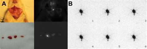 Lymph Nodes From The Dissected Neck And Serial Scintigraphy Four Lymph Download Scientific