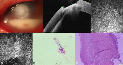 Figure1 Imaging And Histological Examination Of The Patient Case 20