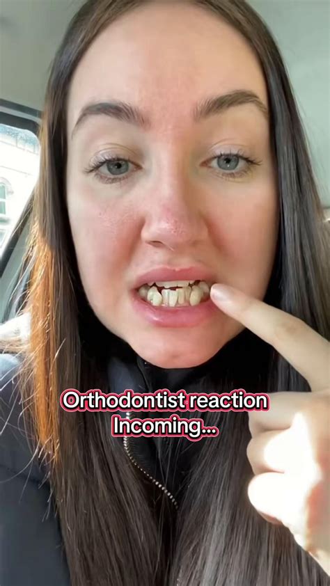 Adult Braces Can Be A Process And Usually Its A Pretty Involved Journey Braces Adultbraces