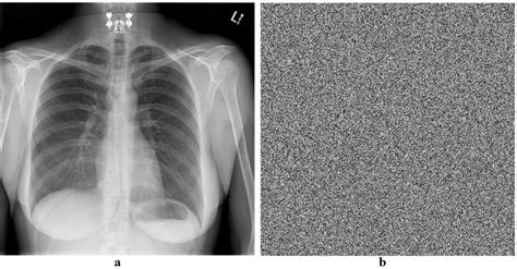 a medical image encryption scheme based on mobius transformation and