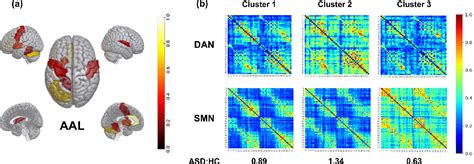 Spatio Temporal Attention In Multi Granular Brain Chronnectomes For
