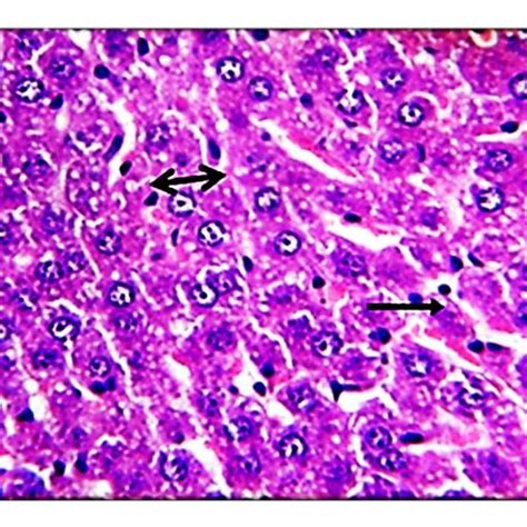Histopathological Section Of Liver Of G2 Rats This Figure Showed
