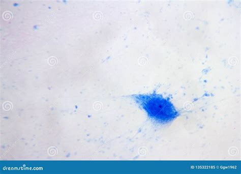 Giant Multipolar Neuron Stock Image Image Of Anatomy 135322185