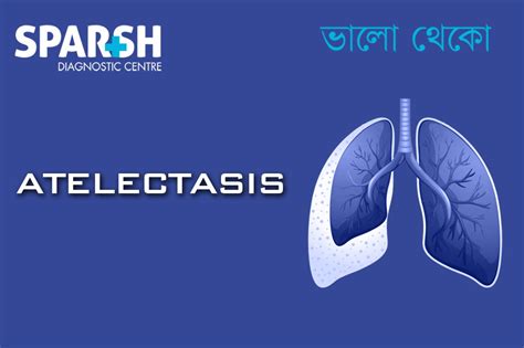 Atelectasis Causes Symptoms Diagnosis And Treatment Sparsh