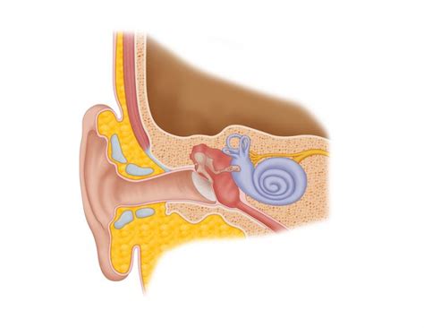 Bone Conduction Hearing Implants Auditory Implant Service