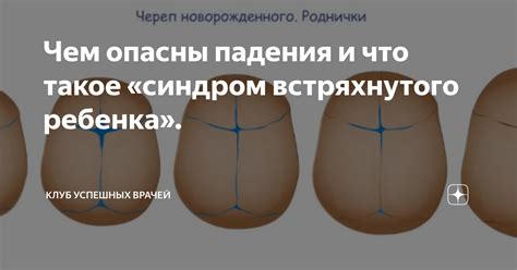 Чем опасны падения и что такое «синдром встряхнутого ребенка Клуб