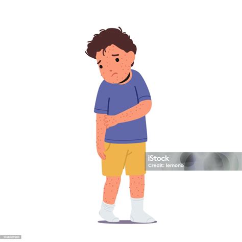 원숭이 수두 질병으로 인해 출혈 농포로 몸을 긁는 불행한 어린 소년 원숭이두 바이러스에 걸린 어린이 캐릭터 아이에 대한 스톡
