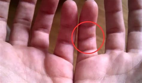 Only A Small Number Of People Have An Extra Crease On Their Pinky Finger