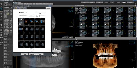 Software de Imágenes 3D OnDemand3D Techdent